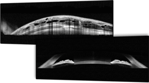 SPECTRALIS® HRA+OCT - Oculamed Medical Electronics