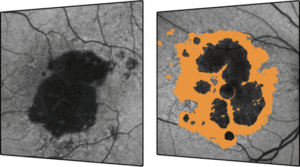 SPECTRALIS® HRA+OCT - Oculamed Medical Electronics