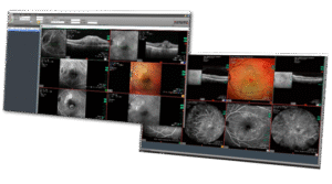 HEIDELBERG EYE EXPLORER - Oculamed Medical Electronics