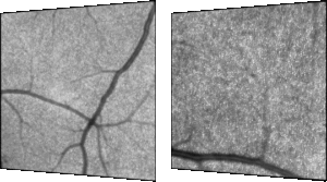 SPECTRALIS® HRA+OCT - Oculamed Medical Electronics