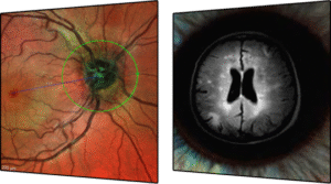 SPECTRALIS® HRA+OCT - Oculamed Medical Electronics