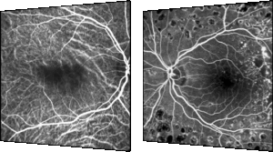 SPECTRALIS® HRA+OCT - Oculamed Medical Electronics