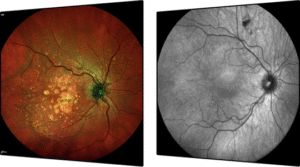 SPECTRALIS® HRA+OCT - Oculamed Medical Electronics